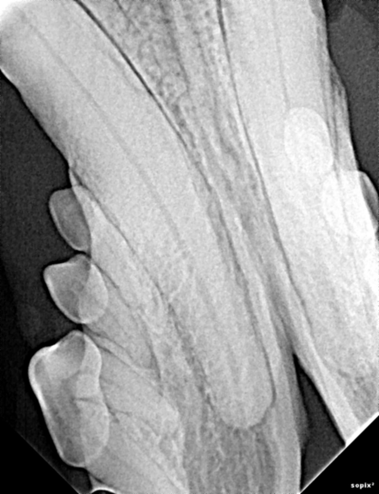 Normal Adult Dental Anatomy Radiographs | VDEC